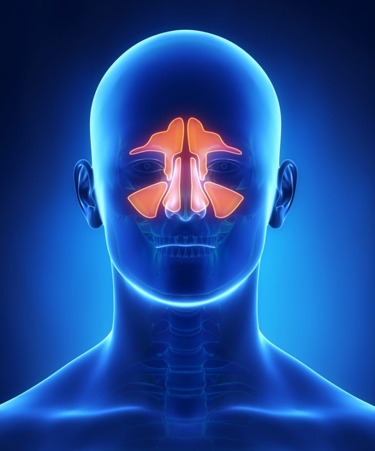 Sobre La Sinusitis - La Clínica de Rinosinusitis LLCSan Juan, PR - Dr ...